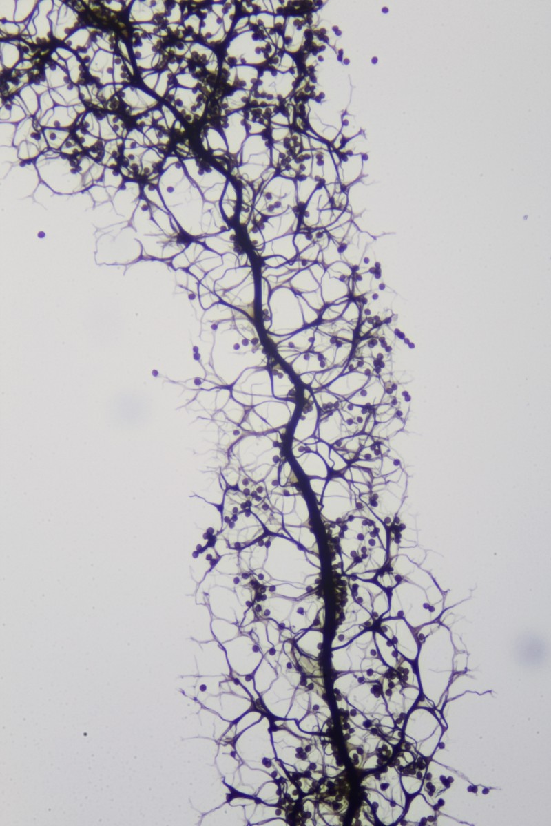 Stemonaria Nann.-Bremek., R.Sharma & Y.Yamam.