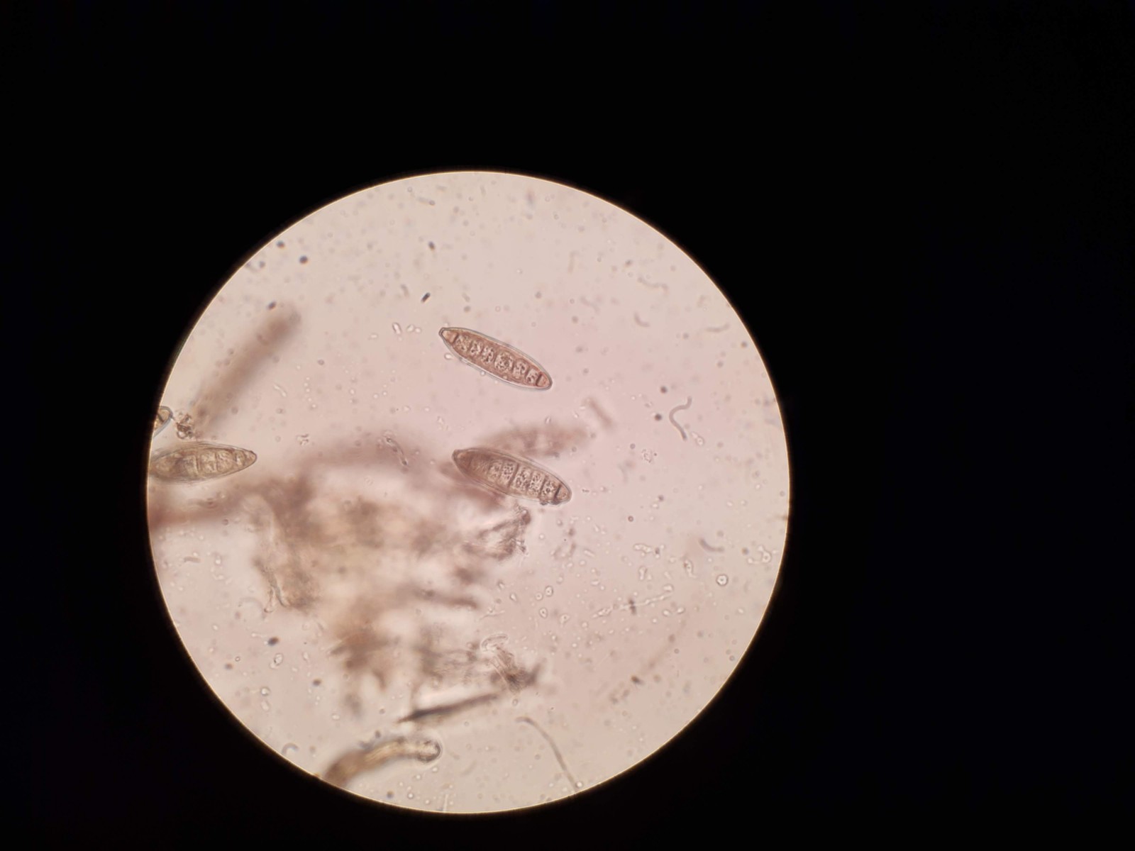 Strossmayeria basitricha (Sacc.) Dennis