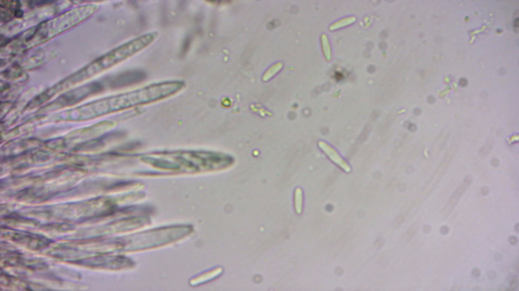 Cyathicula cyathoidea (Bull.) Thüm.