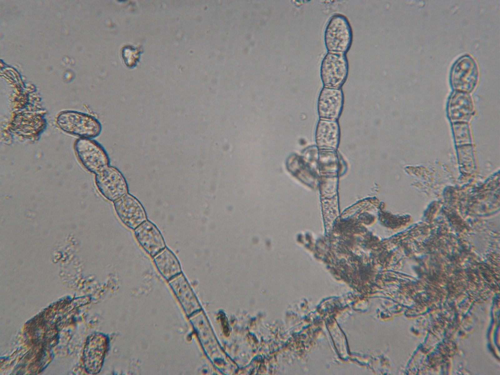 Podosphaera filipendulae (Z.Y.Zhao) T.Z.Liu & U.Braun