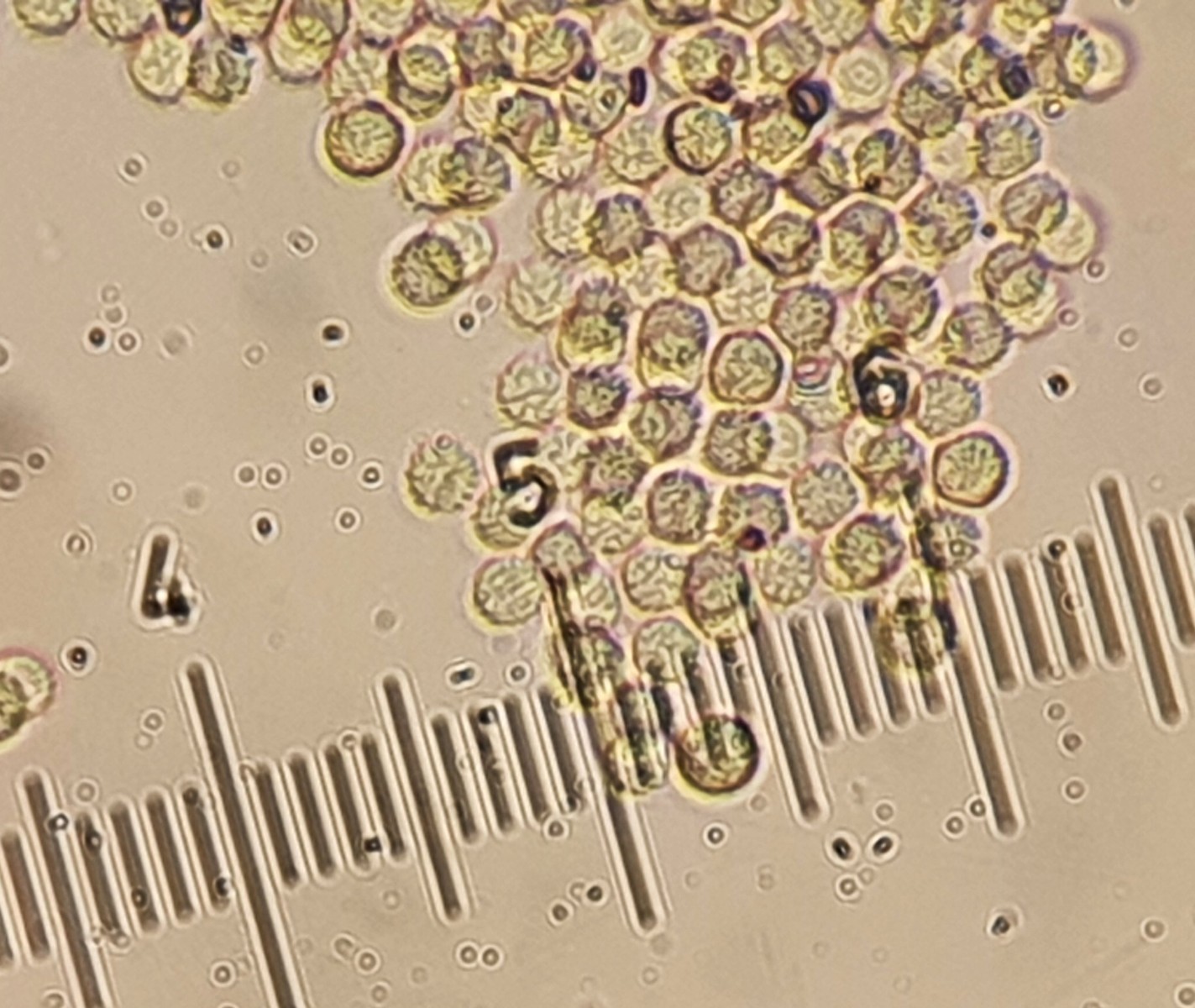 Lycogala epidendrum (L.) Fr., 1829