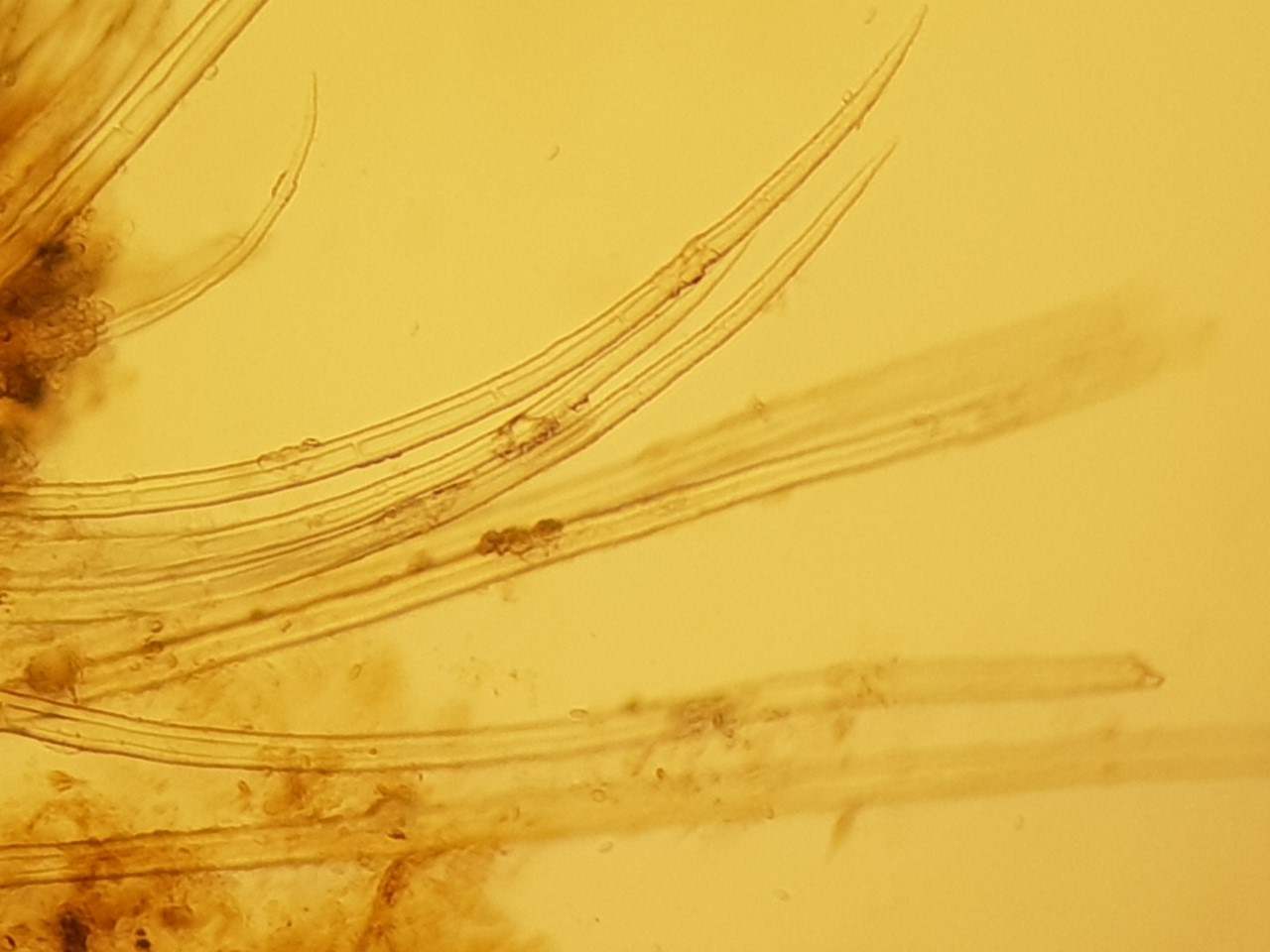 Volutella ciliata (Alb. & Schwein.) Fr.