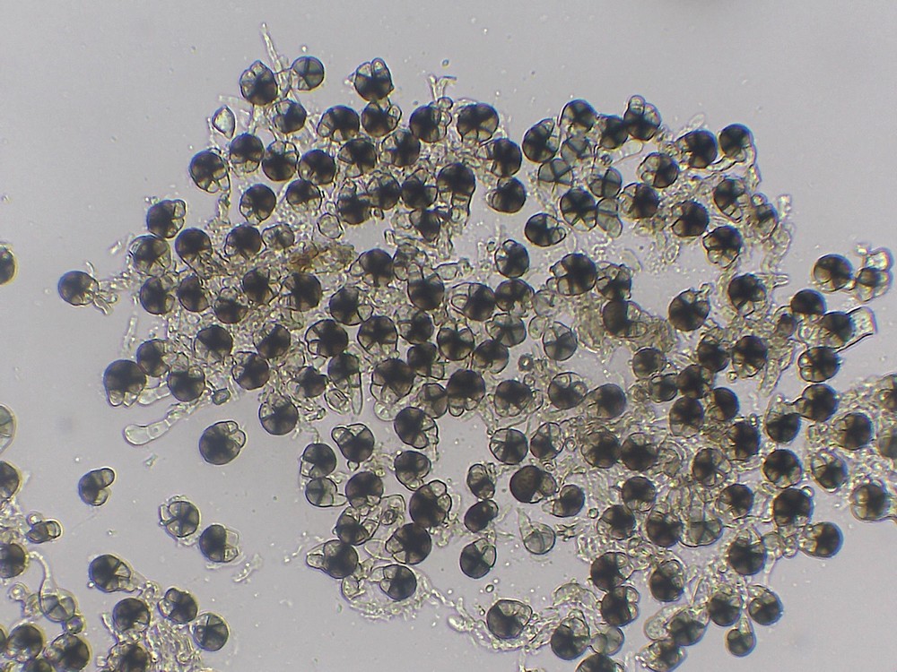 Helicoma monosporum W.B.Kendr.